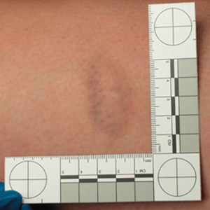 Evident Photomacrographic Scale, 4x4" L-Shaped - Adorama