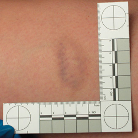 Evident Photomacrographic Scale, 4x4" L-Shaped - Adorama